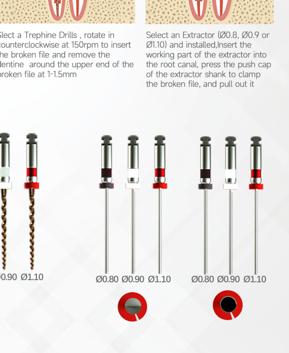 Endo Extractor System - Complete Range of Professional Endodontic ...