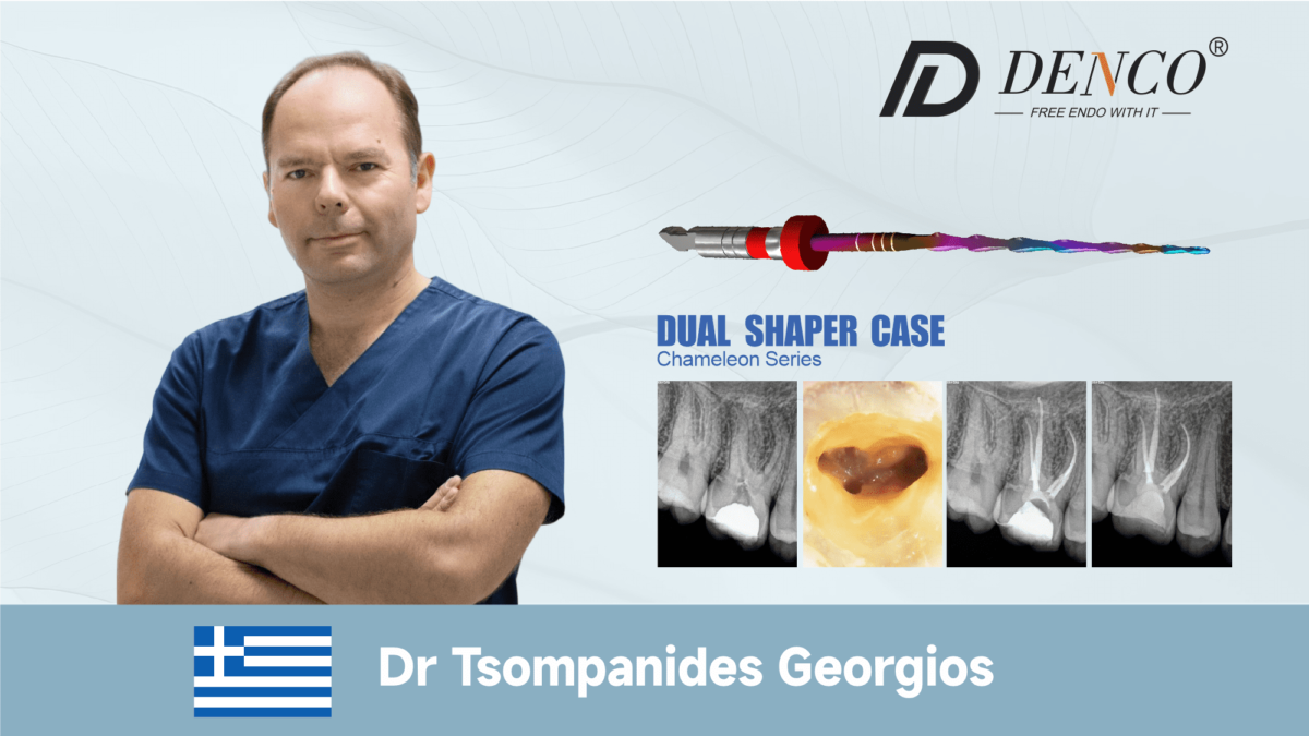 DENCO's DUAL-Shaper Gold in Complex Root Canal Retreatment - Complete ...