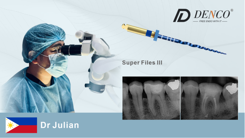 SUPER FILES III - Complete Range of Professional Endodontic Supplies ...